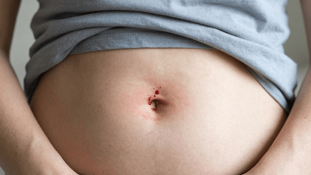 My Navel Is Bleeding: What It Means, When to Worry, and What to Do ...